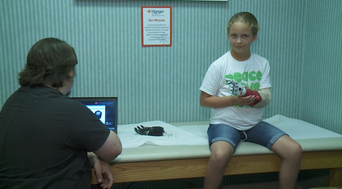 Girl finally gets her dream bionic hand | wwltv.com Girl finally gets her dream bionic hand | wwltv.com