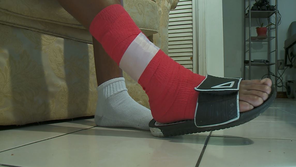 Student arrested in hot water attack that left teen burned | wwltv.com